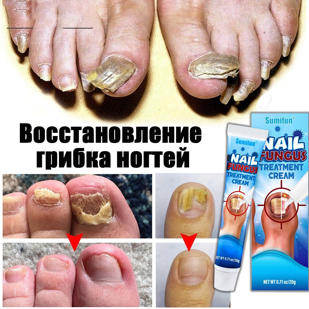 Средство для ногтей и кутикулы купить на OZON по низкой цене (1948175052)