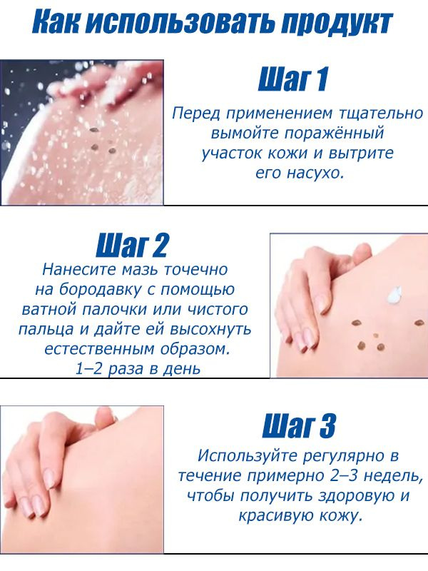 SUSUVETA/Эссенция для удаления бородавок, папиллом и родинок ...