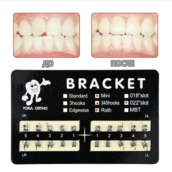 упаковка Стоматологические ортодонтические металлические брекеты Metal ...
