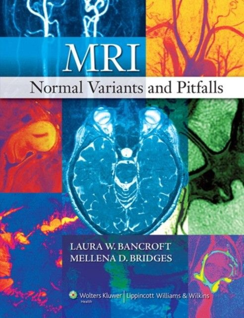 MRI Normal Variants and Pitfalls - купить с доставкой по выгодным ценам в интернет-магазине OZON ...