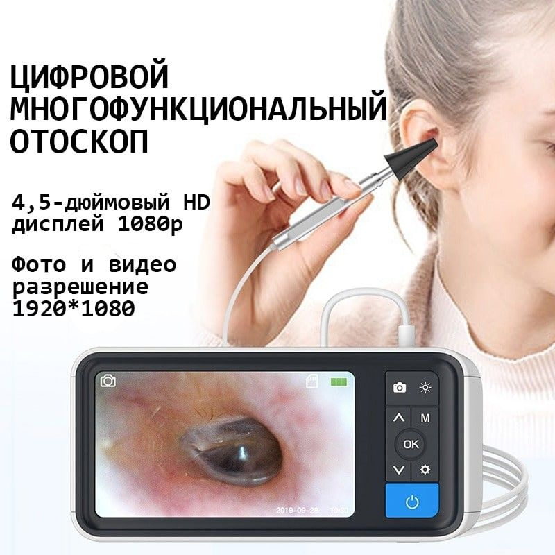 Цифровой многофункциональный отоскоп ANYSMART N1 с ЖК-экраном - купить ...
