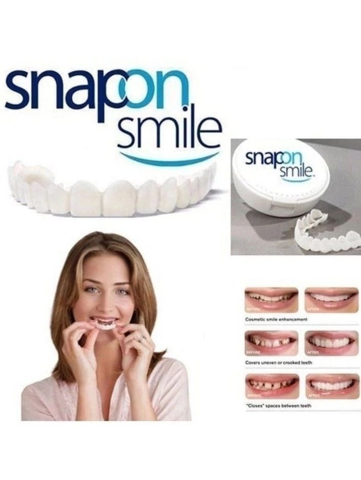Виниры для зубов Snapon Smile белые универсальные купить по выгодной