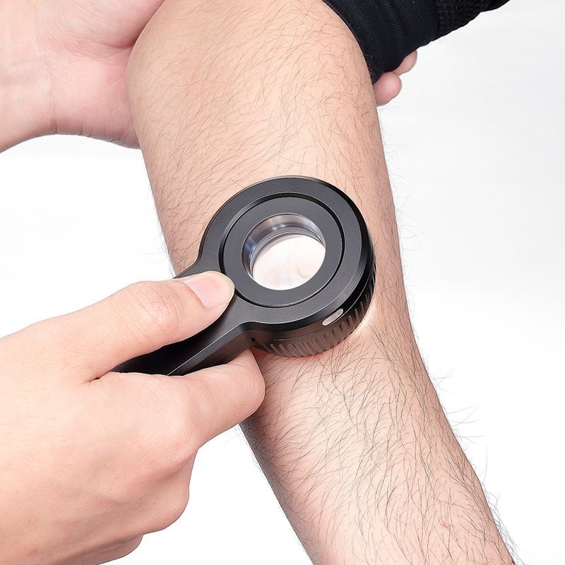 Дерматоскоп 10X Magnify Macro Zoom Lens для дерматологической диагностики - купить с доставкой ...