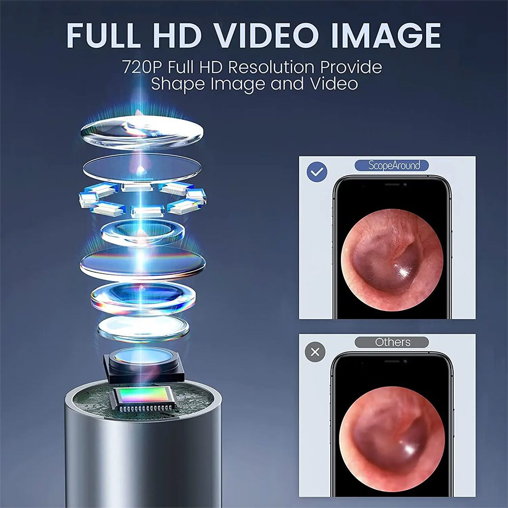 3,9 мм WIFI отоскоп для Android и iOS купить на OZON по низкой цене (1871044293)