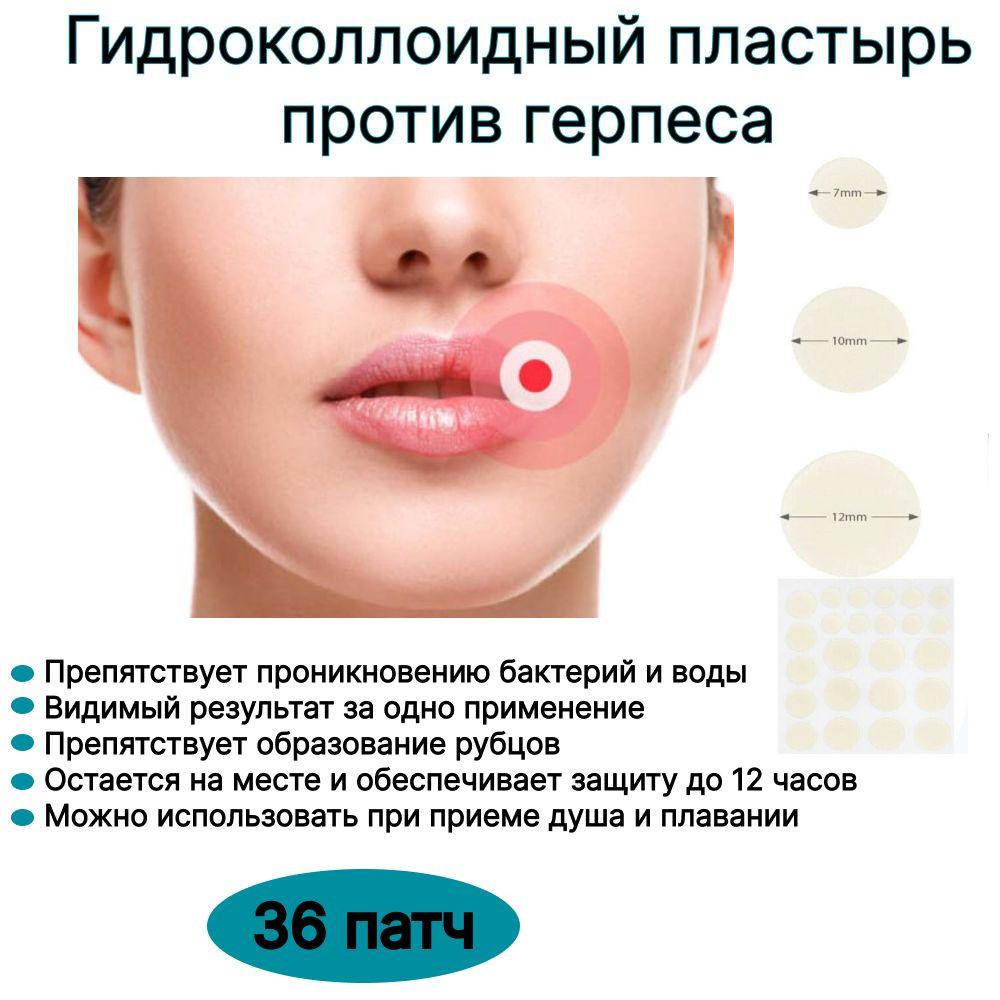 Пластырь гидроколлоидный от герпеса купить на OZON по низкой цене ...