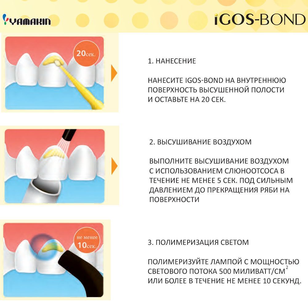 iGOS BOND (5 мл) / бонд стоматологический для эмали или дентина ...