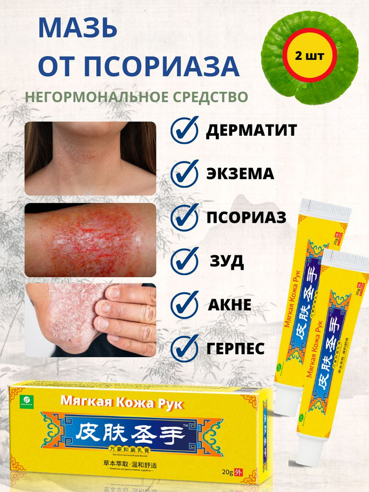 Мазь от псориаза китайская - купить с доставкой по выгодным ценам в ...