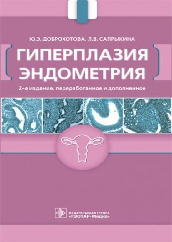 Гиперплазия эндометрия купить с доставкой по выгодным ценам в