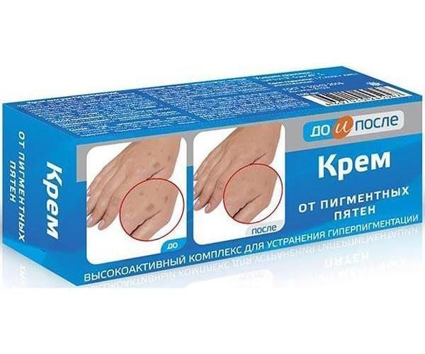 До и После крем от пигментных пятен туба 50 мл купить с доставкой