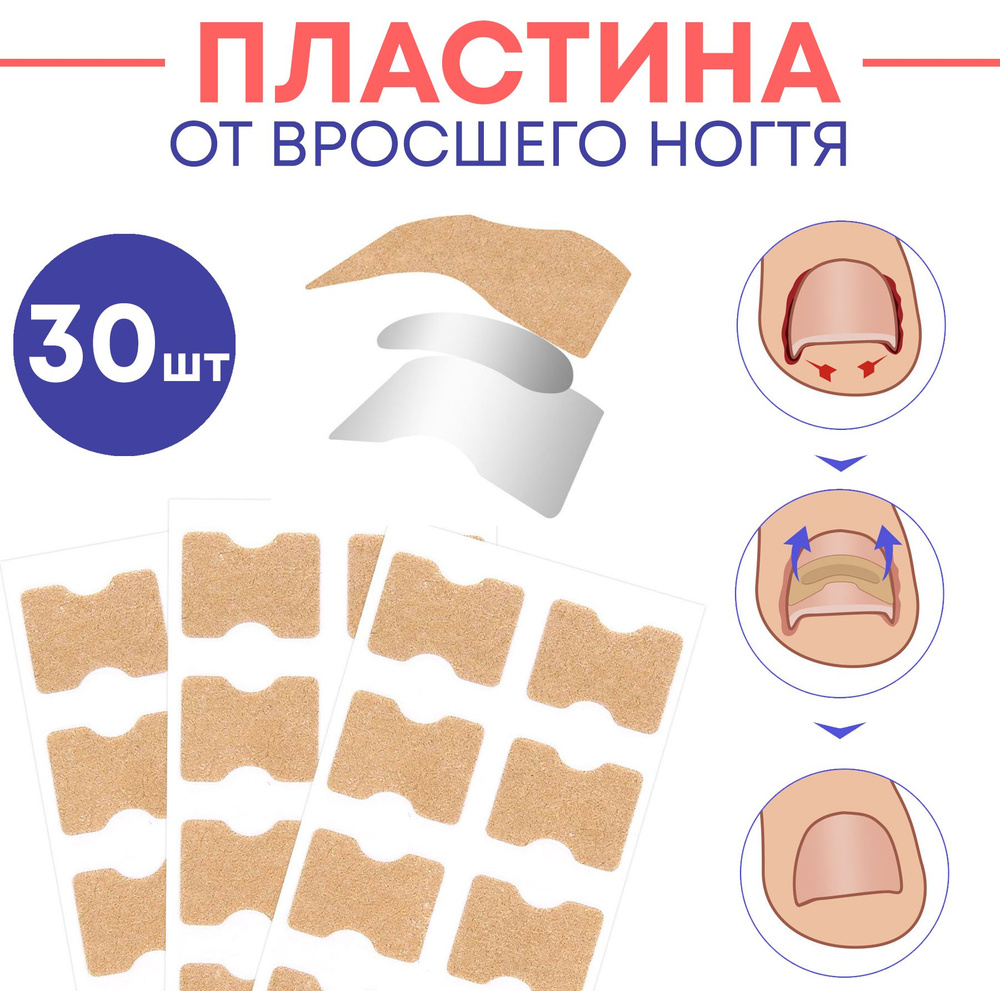 Пластырь от вросшего ногтя, наклейка-пластина на ноготь 30шт - купить с ...