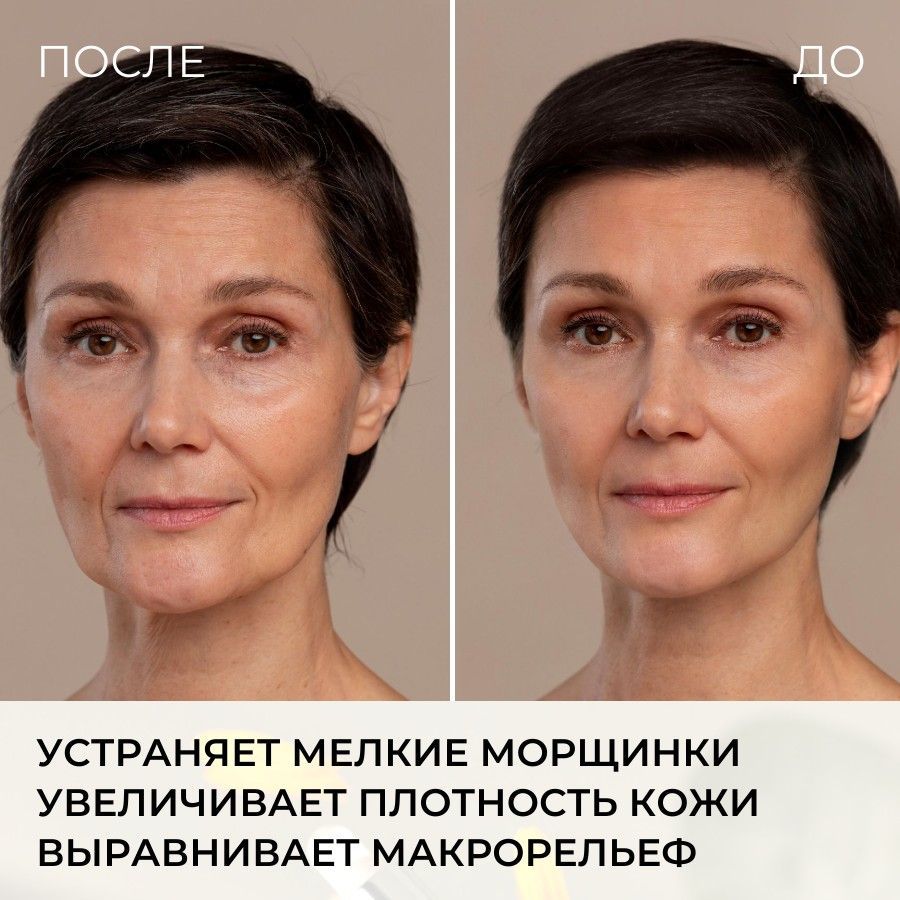 Красный пилинг для лица кислотный, антивозрастной, омолаживающий ...