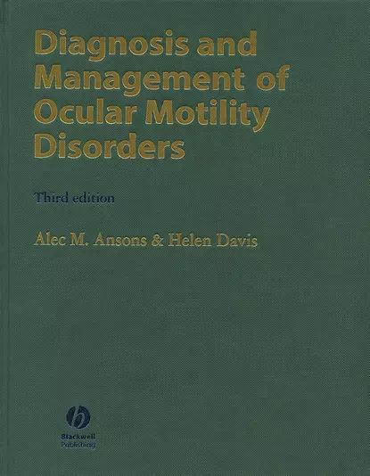 Diagnosis and Management of Ocular Motility Disorders | Davis Helen ...