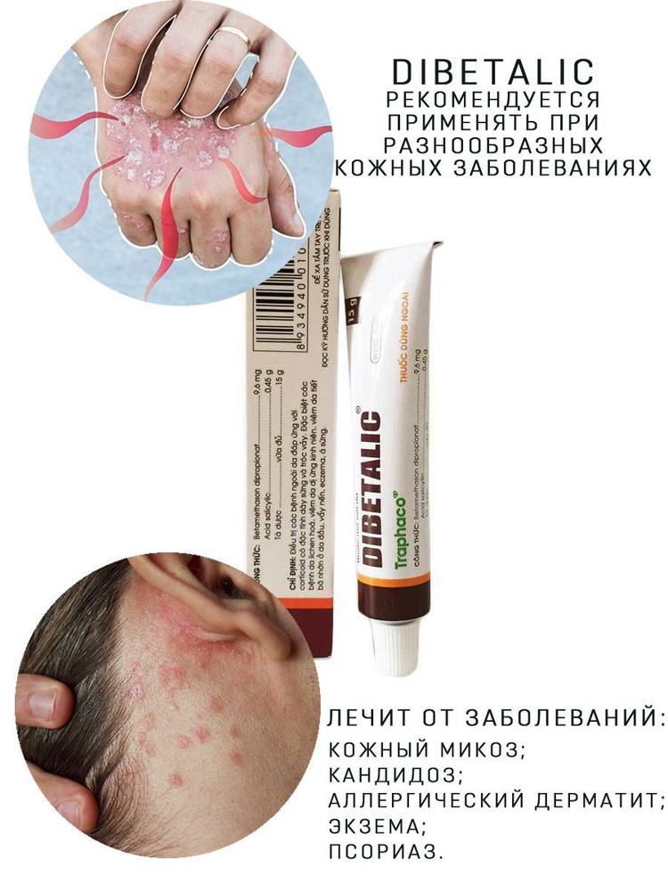 Дибеталик (Dibetalic) Вьетнамская мазь от кожных заболеваний (15 г ...