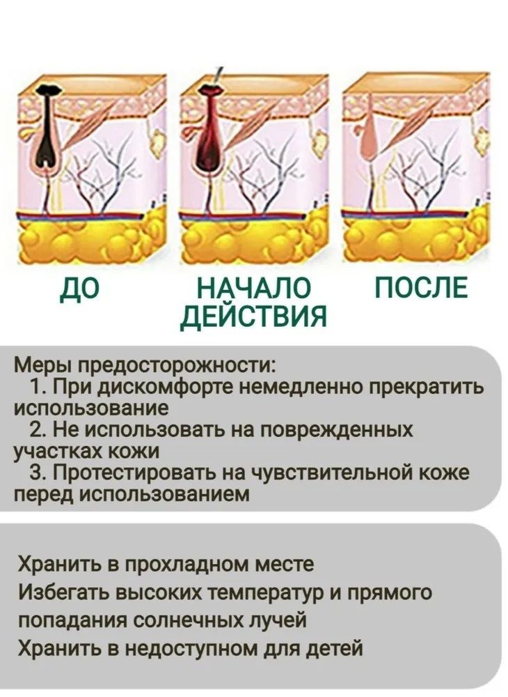 Пластырь от папиллом и бородавок / Патчи от прыщей - купить с доставкой ...
