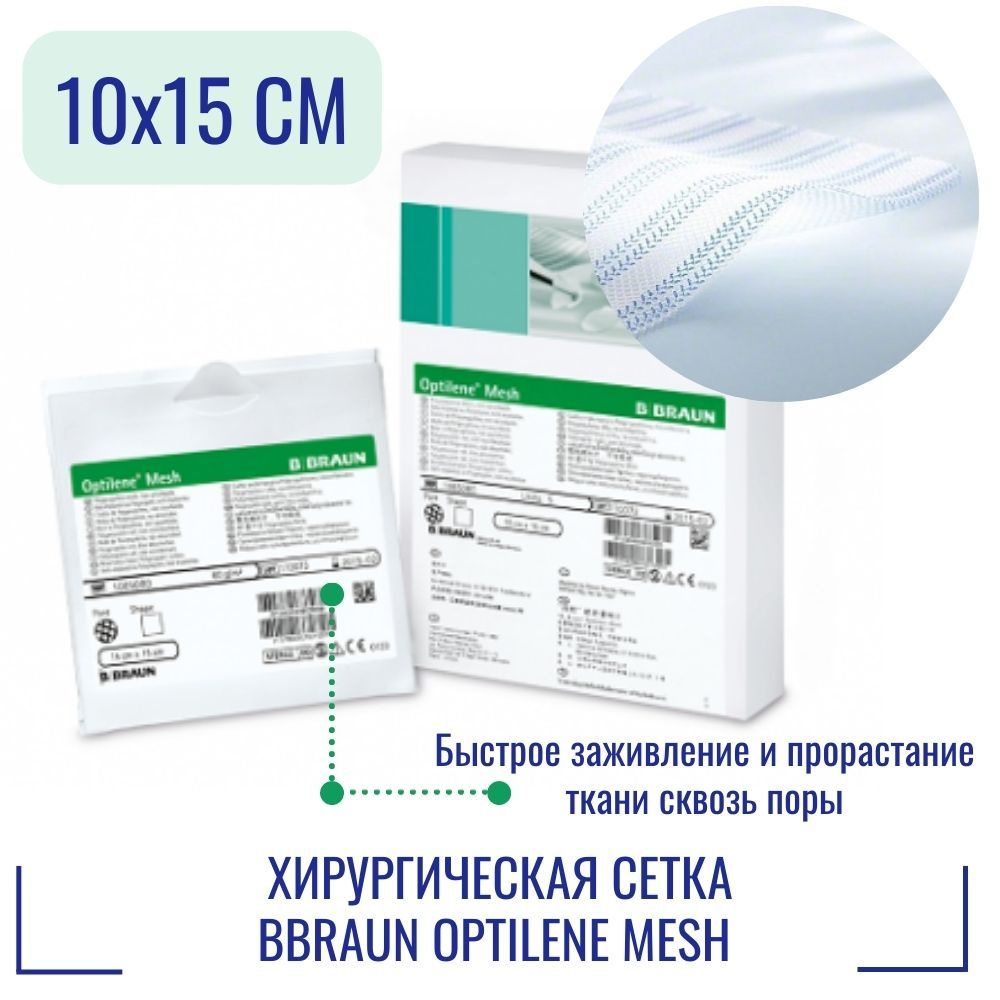 Сетка хирургическая BBraun Optilene Mesh 10х15 см - купить с доставкой ...