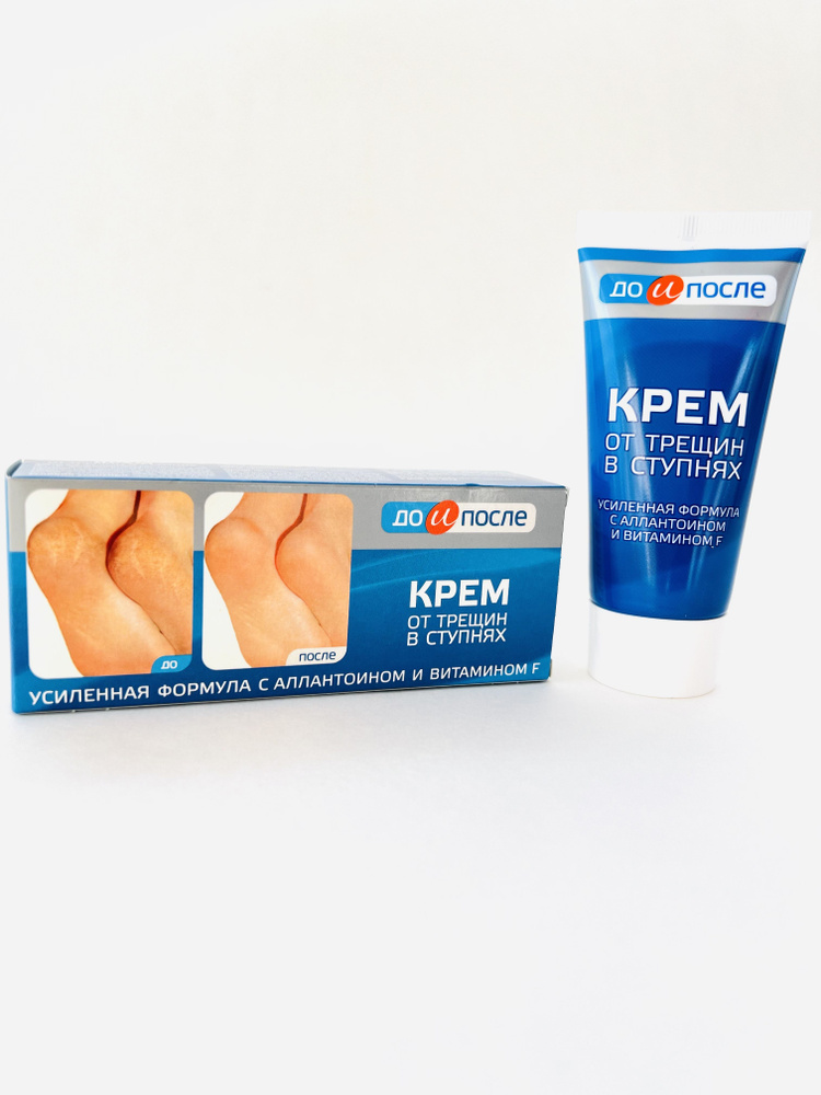 Крем для ног от трещин в ступнях. Бальзам от натоптышей и мозолей, 50 ...