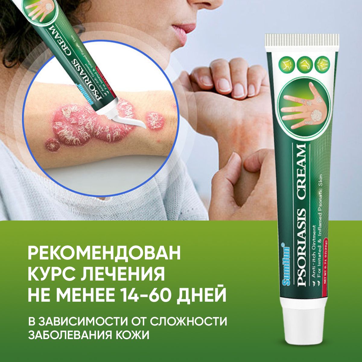 Мазь Крем от ПСОРИАЗА, экземы, атопического дерматита / Китайская чудо ...