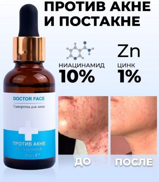 Сыворотка для лица от акне, постакне с цинком и ниацинамидом, средство ...