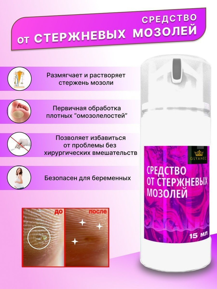 Средство от стержневых мозолей - купить с доставкой по выгодным ценам в ...