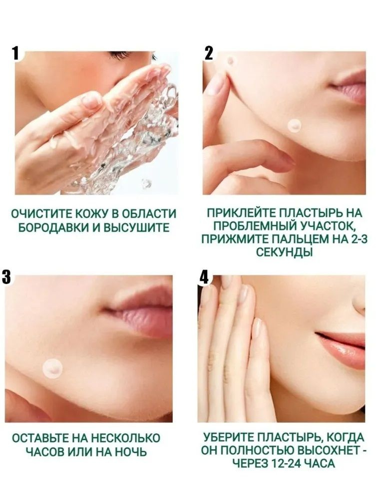 Пластырь от папиллом и бородавок / Патчи от прыщей - купить с доставкой ...