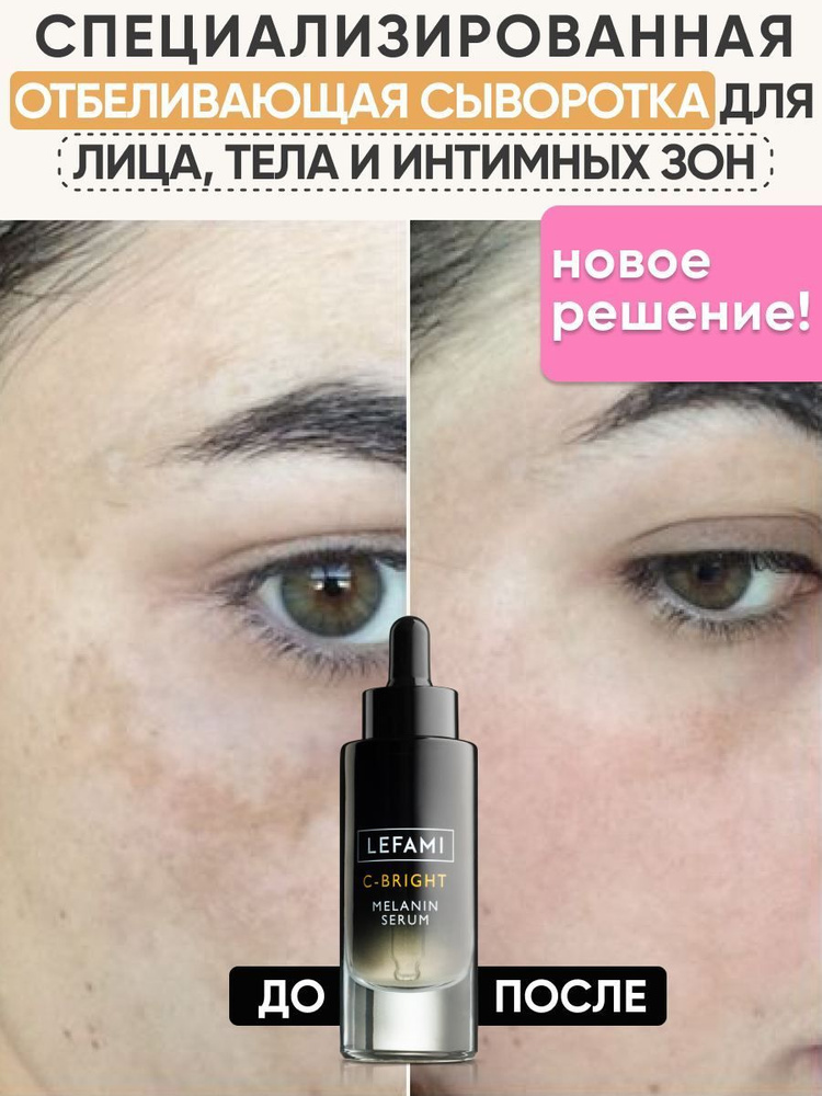 Сыворотка от пигментных пятен купить с доставкой по выгодным ценам в