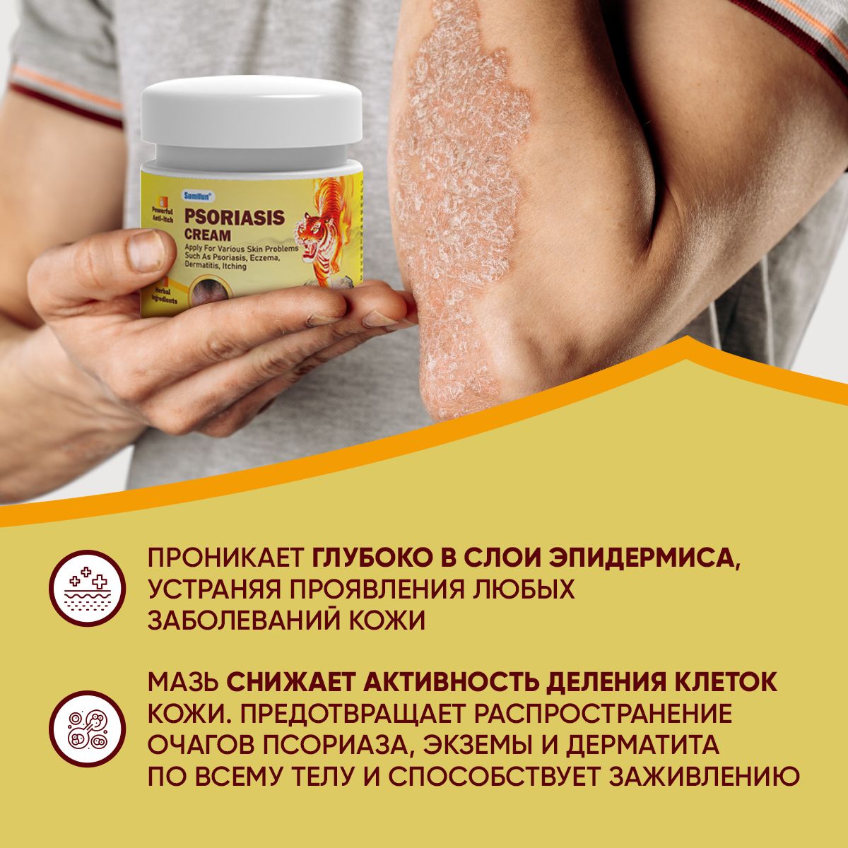 Мазь Крем от ПСОРИАЗА, экземы, атопического дерматита / Китайская чудо ...