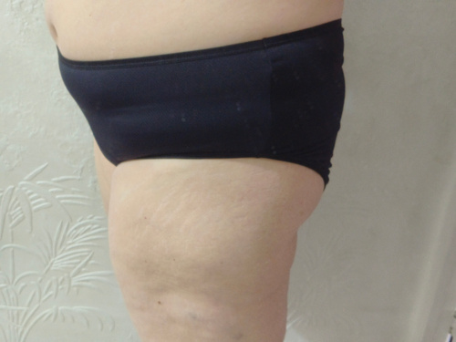 Комплект трусов Женский Remisa слипы Нейлон, Спандекс разноцветный, размер 42, 44 Средняя В ...