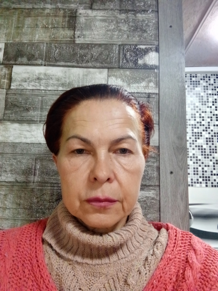 Микротоковый массажер для лица AsiaCare / rf лифтинг / микротоки для лица аппарат купить на OZON ...